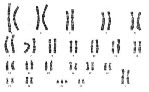Genetics Pre Post Test Flashcards Quizlet