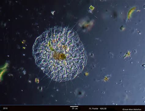 Actinophrys Vesiculata Rhizopodes And Actinopodes Mikroscopia