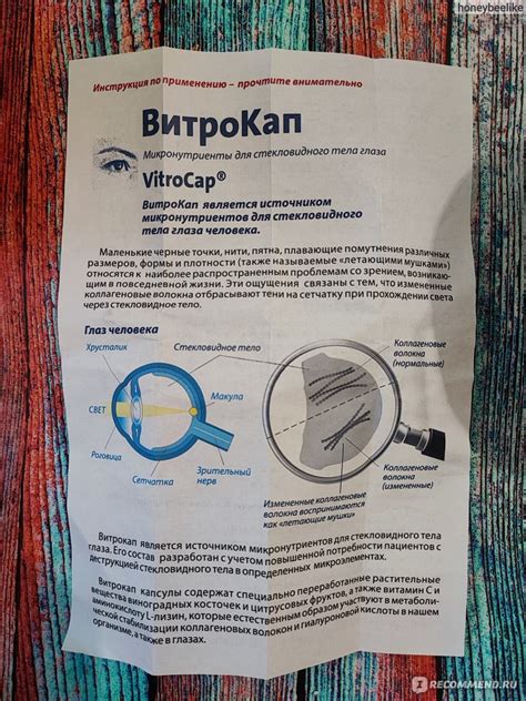 Витамины для глаз Витрокап - «🦟🪱Моя история борьбы с мушками в глазах ...