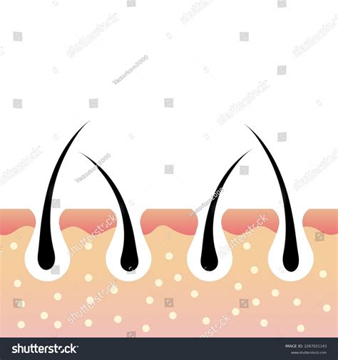 Skin Anatomy Hair Follicle Skin Layers Stock Vector Royalty Free