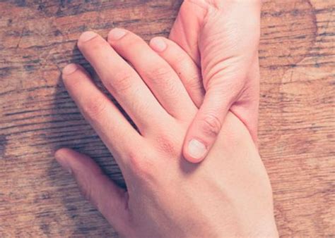 Urticaria qué es y cómo aliviar el picor