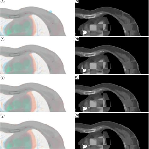 Flowchart Of The Multi‐metric Registration Process Download Scientific Diagram