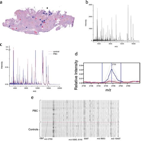 Overview Of Data Acquisition And Analysis Of Maldi Ms Data Obtained Download Scientific Diagram
