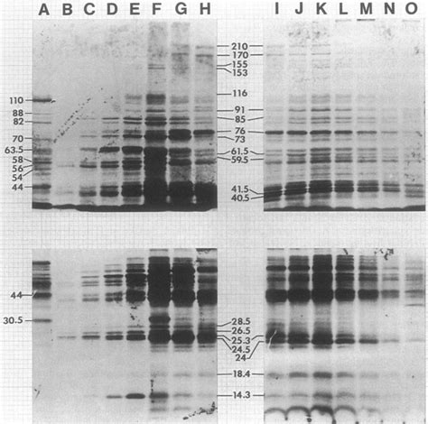 Autoradiography Of Proteins Pulse Labeled With 35s Methionine At