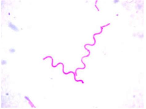 Week 4 Pre Lab Smear Prep Simple Stains And Negative Stains Flashcards Quizlet