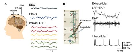 Figure 1 From Revealing Neuronal Function Through Microelectrode Array Recordings Semantic Scholar