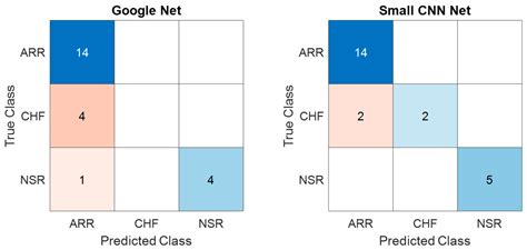 Deep-Learning-Based Arrhythmia Detection Using ECG Signals: A ...