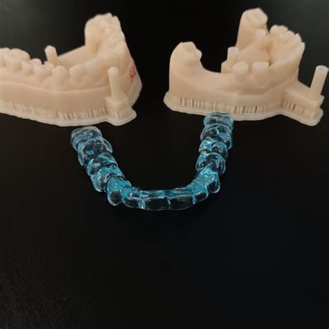 3d Printable Digital Bruxism Tray Splint 3 Stl Files Tray Model Antagonist ・cults