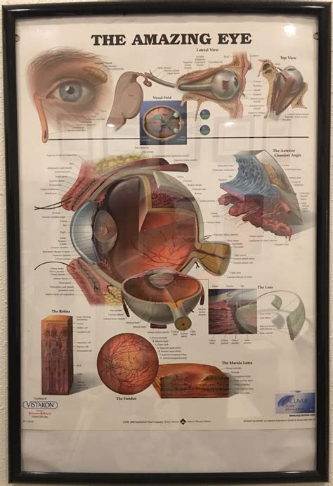 Posters Bristol Optometry