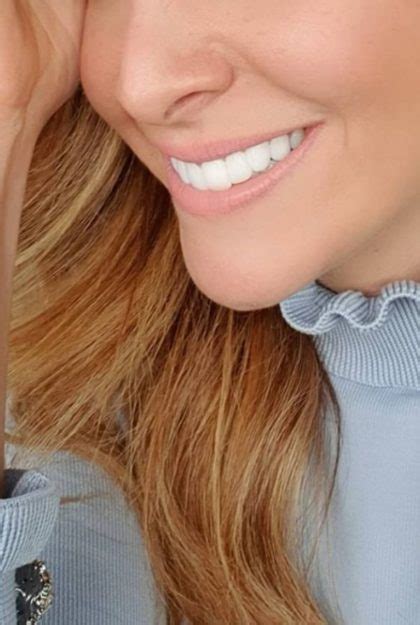 ¿cómo Lograr La Sonrisa Perfecta Estilodf
