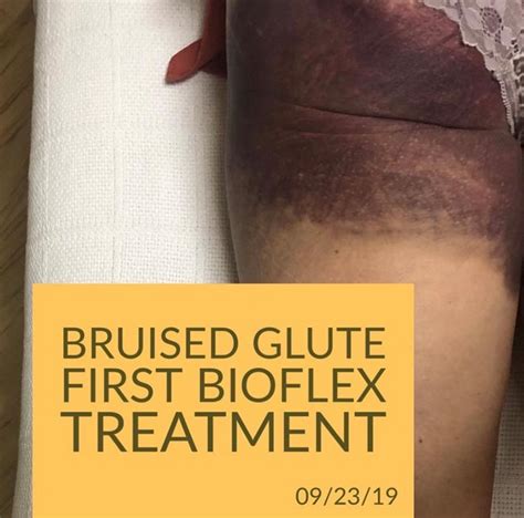 Laser Massage Laser Massage Therapist Houston Tx Andaman Spa