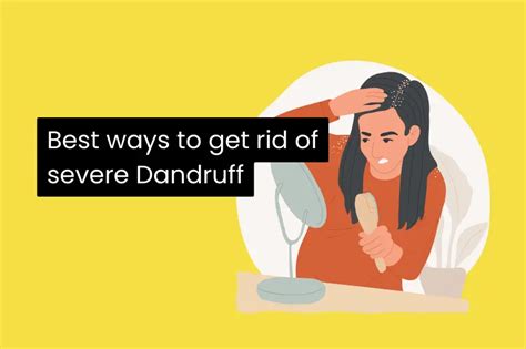 Top Remedies To Get Rid Of Dandruff Hair Care Clinic In Bangalore