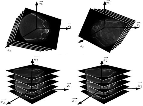 Volumetric Upper Airway Visualisation Using Cbct Cross Sectional Images