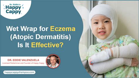 Wet Wrap For Weeping Eczema At Kathleen Delgado Blog