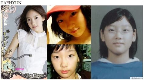 GAMBAR ARTIS WANITA KOREA YANG PERNAH MELAKUKAN PEMBEDAHAN PLASTIK PiNg SaMa DiA