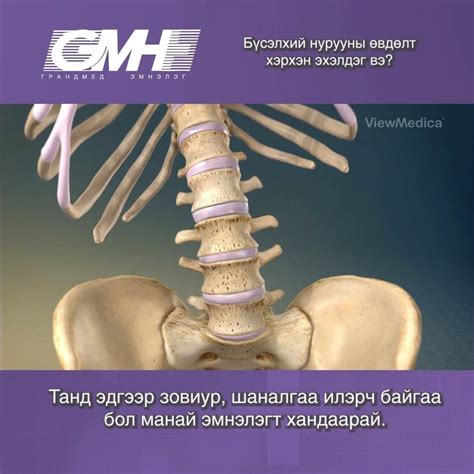 Бүсэлхий нурууны өвдөлт хэрхэн эхэлдэг вэ Бүсэлхий нурууны өвдөлт хэрхэн эхэлдэг вэ ☎️7700