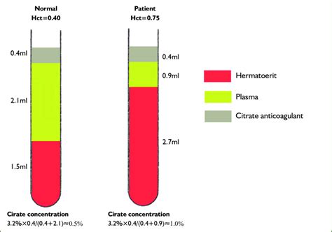 The Effect Of Hematocrit On Relative Volume Of Citrate Anticoagulant In Download Scientific