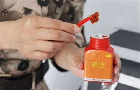 碘伏和碘酒一样吗碘伏的价格 随意云