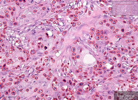 Question About Using Qupath Script To Detect Cells Image Analysis