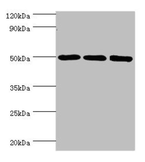 Zmynd10 Rabbit Anti Human Mouse Polyclonal Invitrogen 100 μl