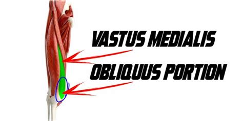 Activate And Strengthen Your Vmo With This Science Proven Exercise