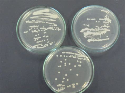 【微生物利用3年】酵母の分離実験