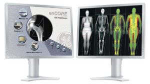 Understanding Your DEXA Scan Report