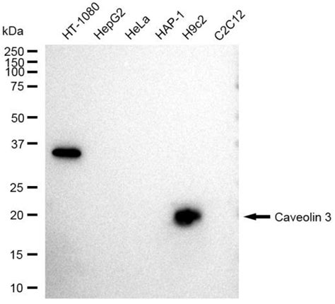 Caveolin 3 Recombinant Rabbit Monoclonal Antibody 23gb3035