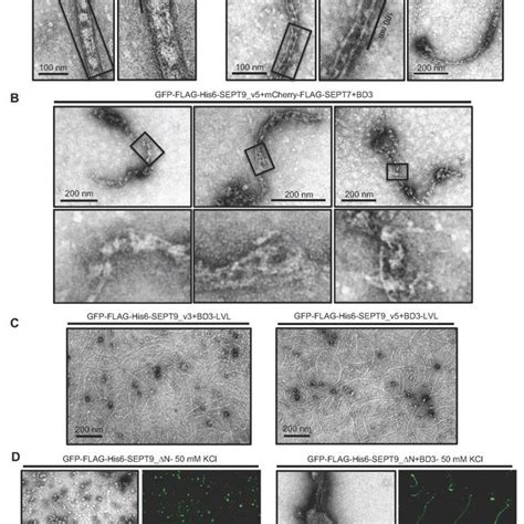 Bd3 Domain Alters The Polymerization Of Mammalian Septin Hexamers