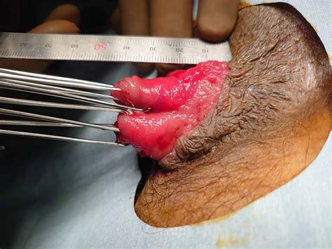 Side View Of CMP After ISR Download Scientific Diagram