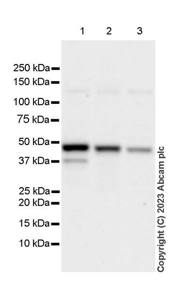 Interferon Regulatory Factor 9 Irf 9重组抗体[epr27554 69] Interferon