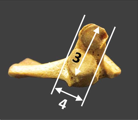 Location Of The Length 3 And Width 4 Of The Anterior Synchondrosis Download Scientific