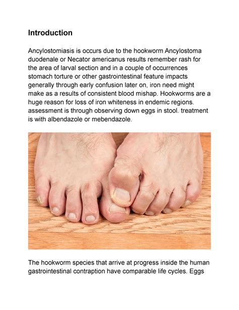 Ancylostomiasis Introduction Ancylostomiasis Is Occurs Due To The Hookworm Ancylostoma