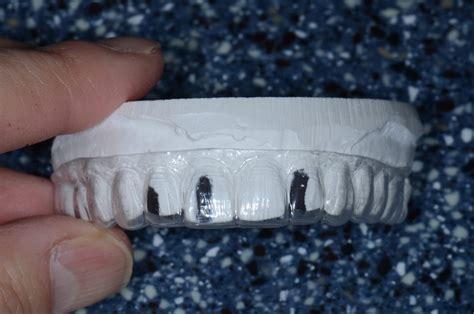 Using A Reduction Matrix Restorative Nation