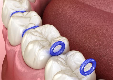 Ann Arbor Orthodontics