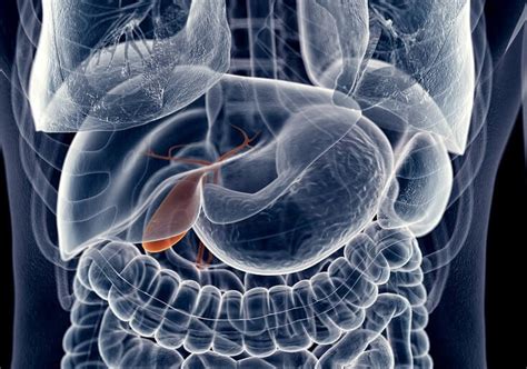 5 Long Term Side Effects Of Gallbladder Removal You Need To Know
