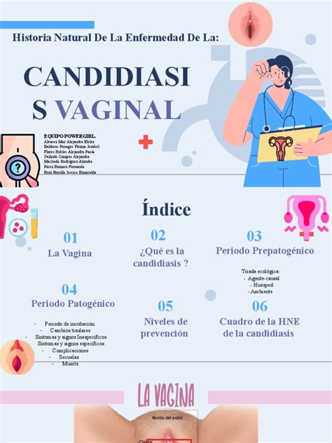 Candidiasis Vaginal Pdf Candidiasis Vagina