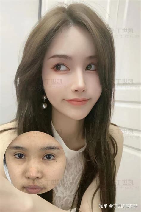 什么脸型适合什么样的鼻子？ 知乎