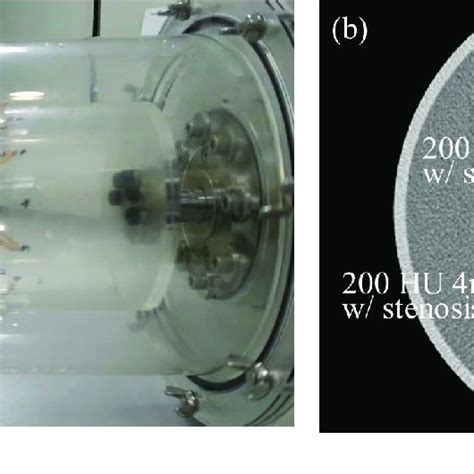 CT Scan Setup Of The Alpha Phantom A In Order To Mimic Heart Chamber Download Scientific