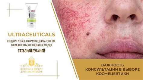 Важность консультации в выборе космецевтики. Уход Ultraceuticals при ...