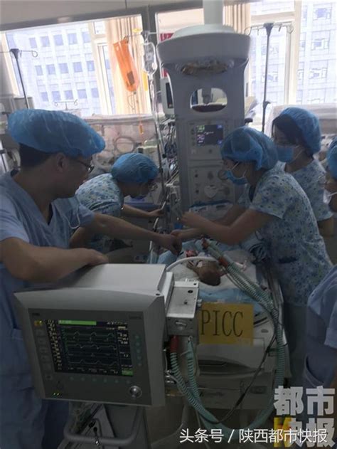 26周早產女嬰僅重兩斤 今天心臟手術成功 每日頭條