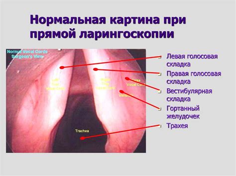 Заболевания гортани - презентация онлайн
