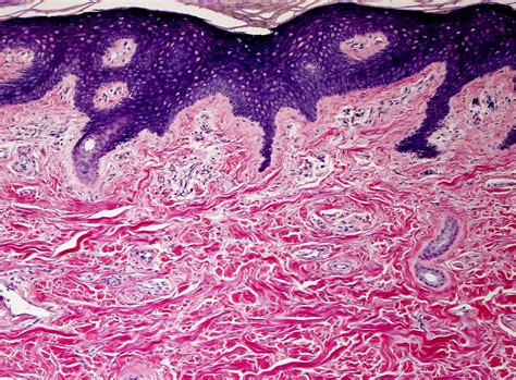 Broad Range Of Tissue Block Scientist Live