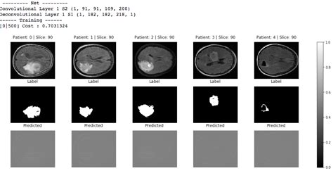 Python Tensorflow Simple 3d Convnet Not Learning Stack Overflow
