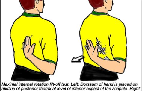 Subscapularis Muscle Testing Dynamic Chiropractic