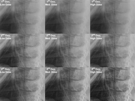 Image Processing Radiology Suny Upstate