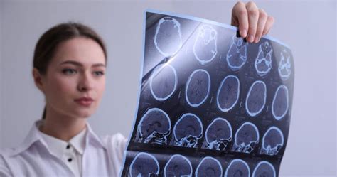Subdural Hematoma Icd 10 Codes Key Classifications
