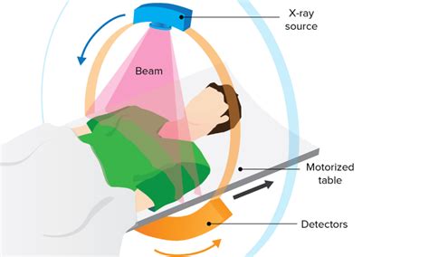What Can CT Scans Detect Kiran Lab