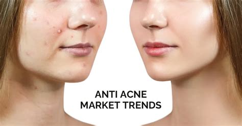 Top 9 Tiktok Beauty Trends 2024 And 2025