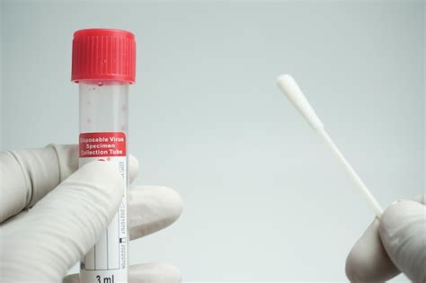 Premium Photo Holding Disposable Virus Specimen Collection Tube Take